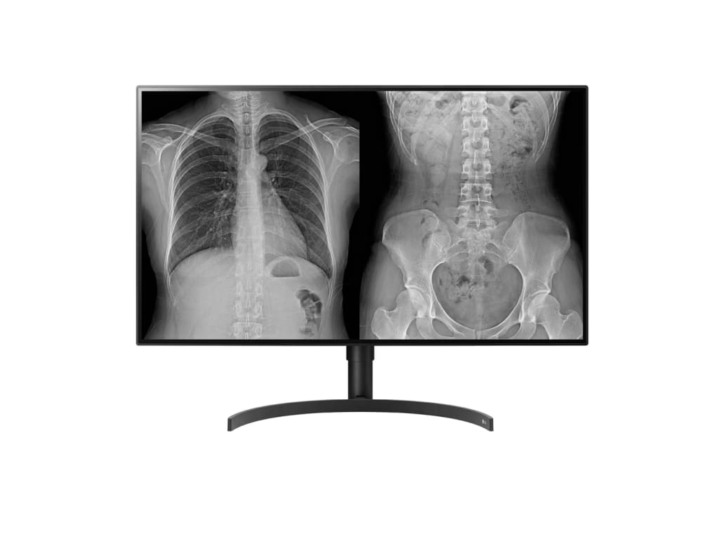 LG 32HL512D-B - 31.5'' 8MP 4K Nano IPS Color Diagnostic Monitor with M
